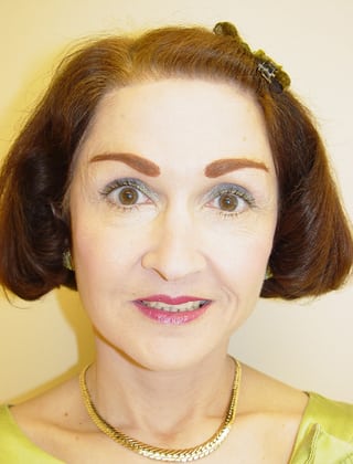 Before & After Facelift Photos - Page 2 of 2 | Dr. Kimberly A. Henry
