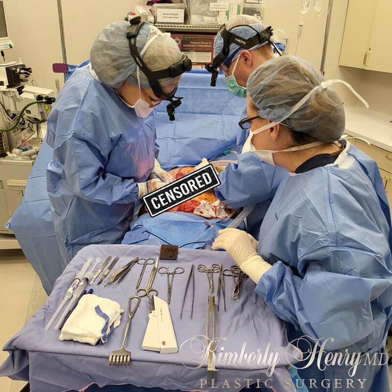 Top Cosmetic Surgeon in California, SF, Bay Area & Marin County