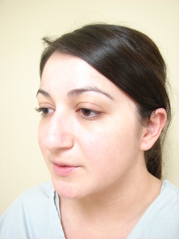 Case #7702 - Kimberly Henry M.D. Plastic Surgery